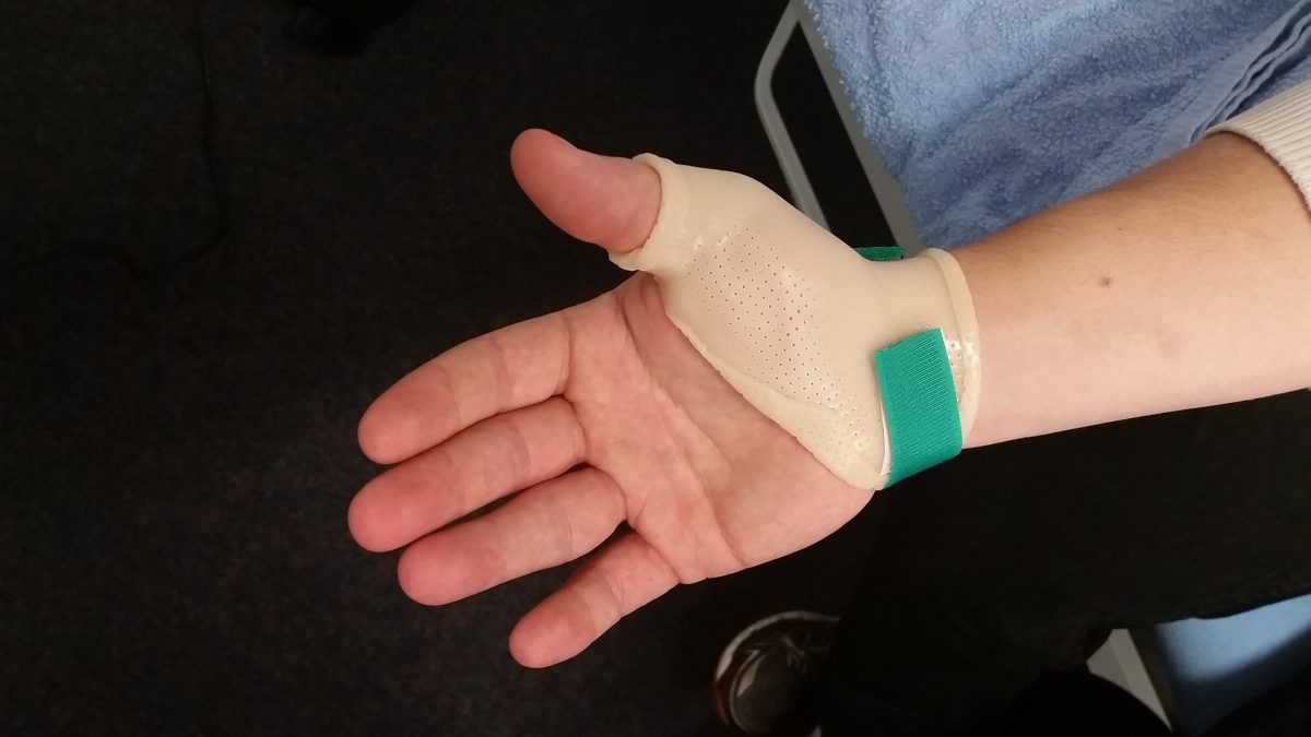 Kids, fractures & growth plates - Arrow Physiotherapy